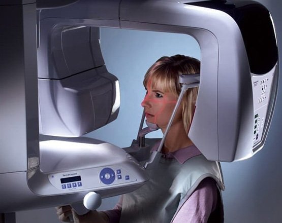 Snimanje zuba - Ortopan - 3D snimanje Beograd